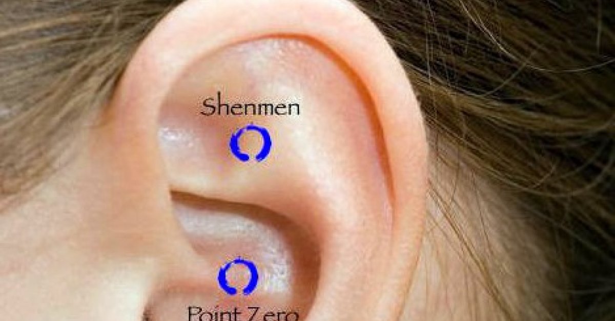 The Doctor's Advice Taking The Internet By Storm: "Massage This Ear ...