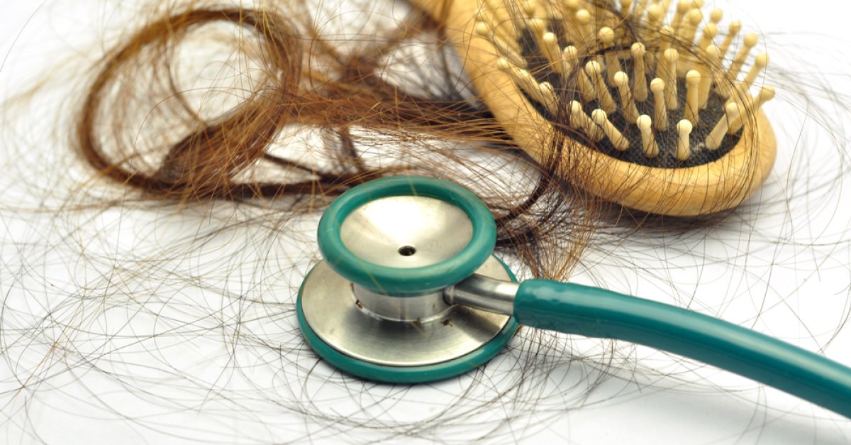Dealing with Hair Loss: Tips and Remedies - Hidabroot